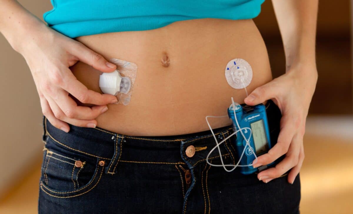 Artificial pancreas hailed a ‘landmark’ for diabetics