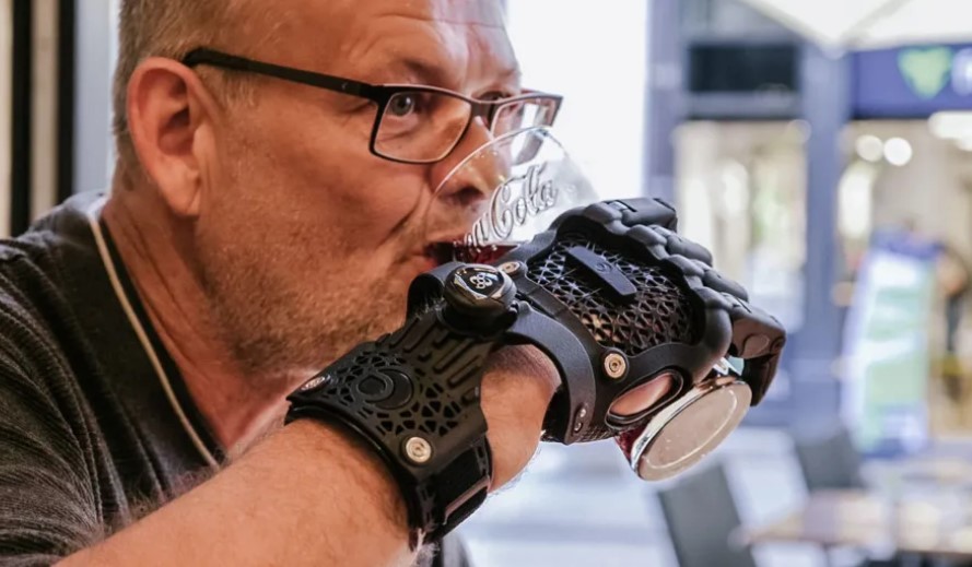 Bionic Arm Advanced Bionic Arm And Hand Technology | Disability