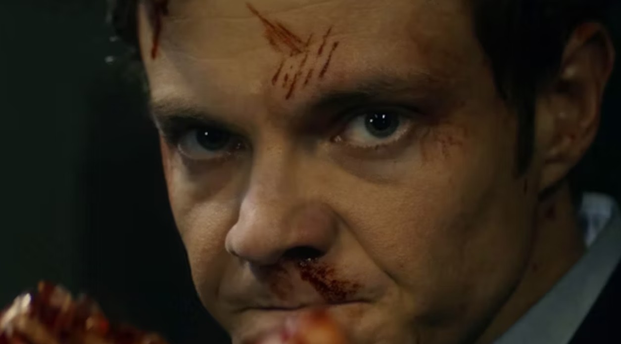 Novocaine - the superhero with a genuine real life condition