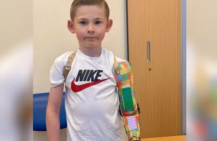 Eight-year-old boy receives prosthetic LEGO arm