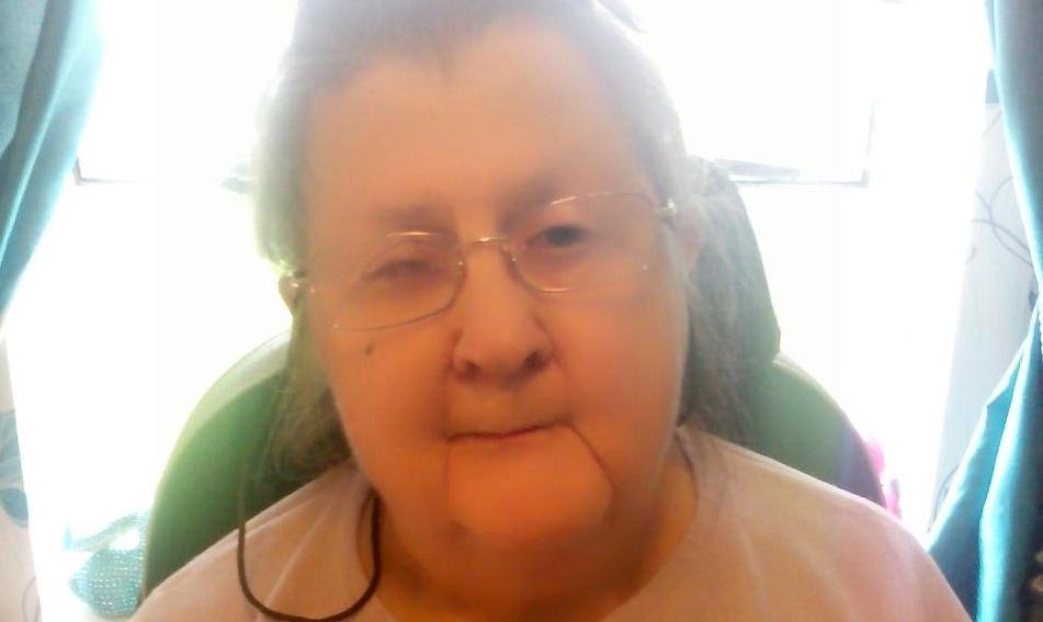 Man cuts off disabled woman’s hand to steal her ring