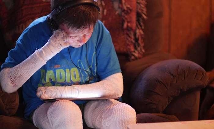 The Boys With No Skin