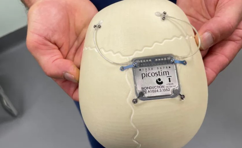 Pioneering device controls epileptic seizures